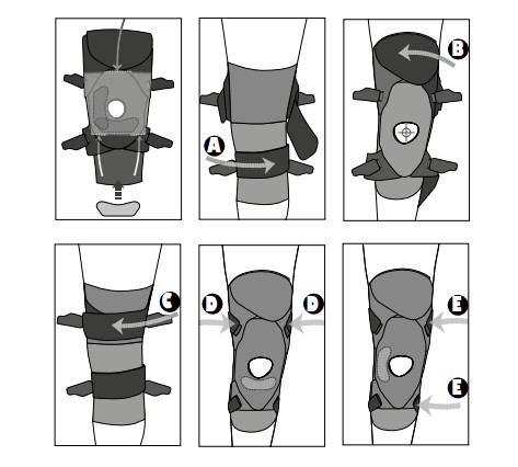Allard Selection Patella Knee Support - KneeSupports.com